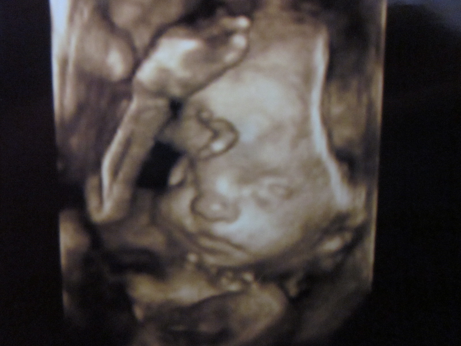 Meagan: Photos: 27 week ultrasound
