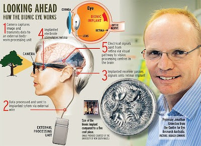 BIONIC EYE - FROM DARKNESS TO LIGHT