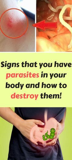 Signs that you have parasites in your body and how to destroy them ...