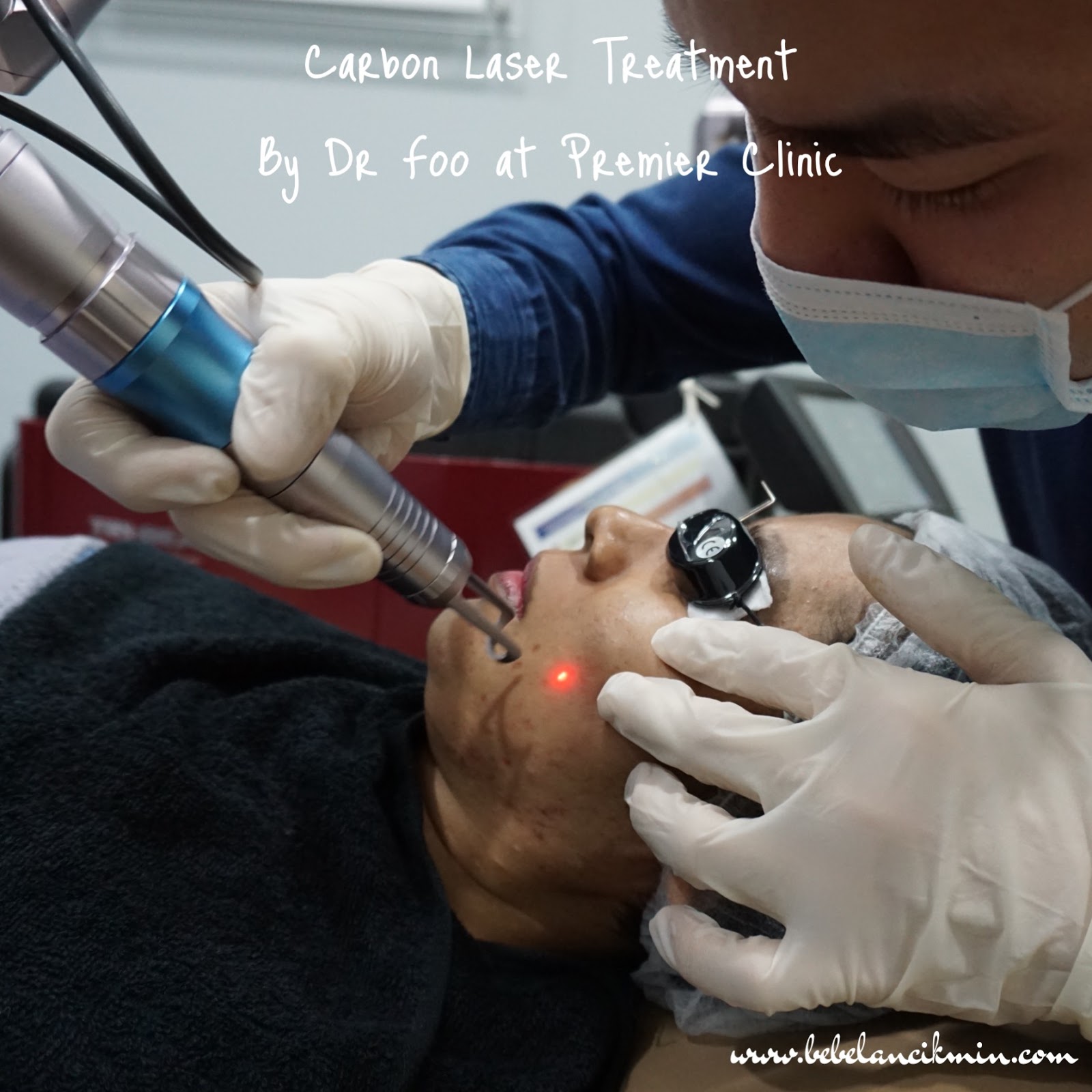 Rawatan Karbon Laser Kaedah Terkini Untuk Kulit Sihat Menawan di ...