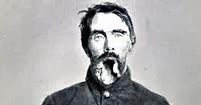 The First Civil War Photographs of Soldiers with Facial Wounds. ~ Civil ...