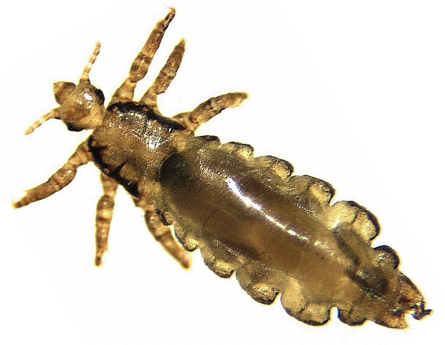 Enfermería Pediátrica: Piojos en niños.