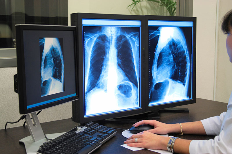 UK Visa TB Test Clinics In Pakistan 01 22 21 uk-visa-tb-test-clinics-in-pakistan-01-22-21