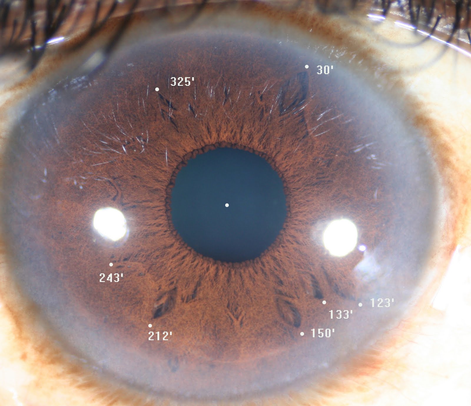 Modern & Multidimensional Iridology: Classical & Embryological - Inner ...