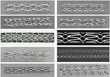 COCHIN CARDIAC CLUB: CORONARY STENTS