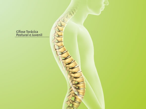 Na Trilha do Castelo: Problemas de coluna!...