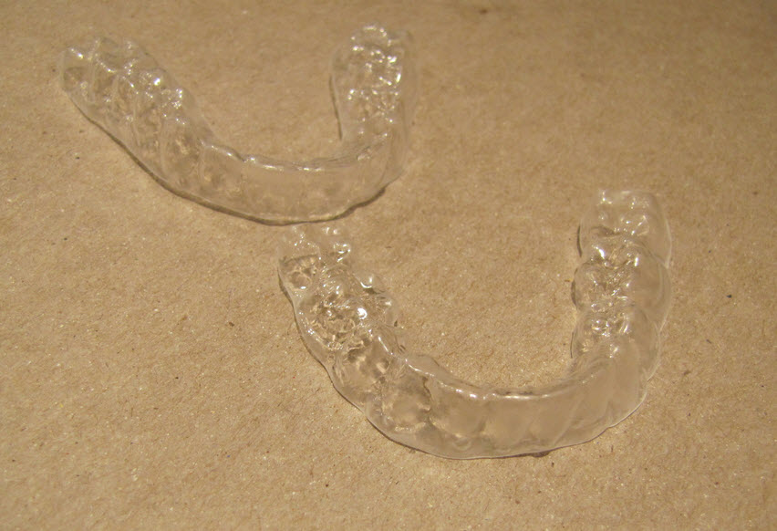 Double Jaw Operation - The Road to Recovery