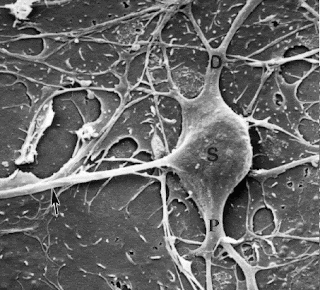 Chau-io in Bio: [BOW] Same Object, Different Microscopes
