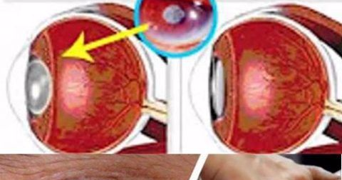 THROW AWAY YOUR GLASSES! ONLY USING THIS ONE INGREDIENT WILL HELP YOU ...