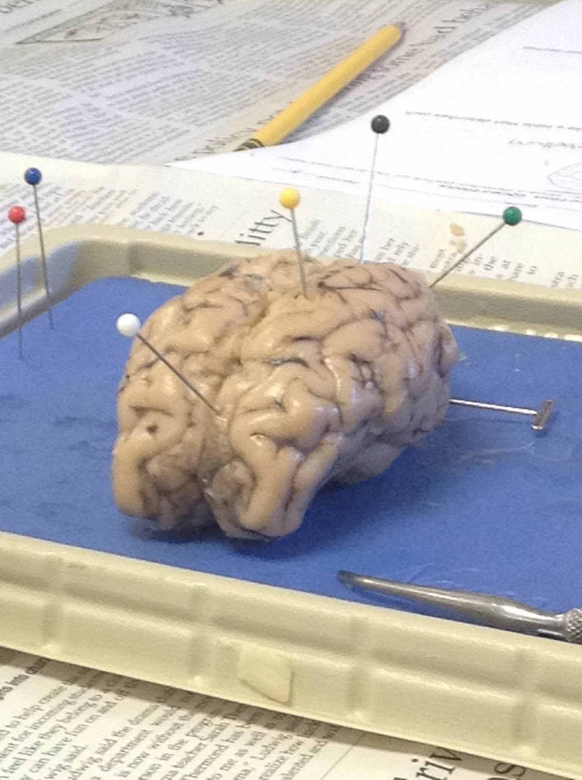 Just another Anatomy blog: Brain Dissection