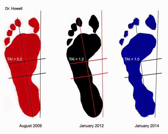 The Barefoot Professor: From Opinion To Observation: More Evidence That ...