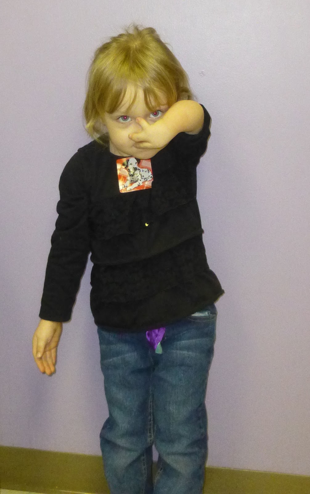 Ulnar deficiency, considerations for surgery | Congenital Hand and Arm ...