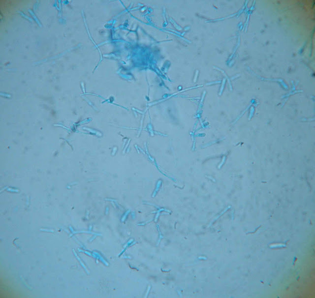 ATLAS MICOLOGIA: EPIDERMOPHYTON FLOCCOSUM