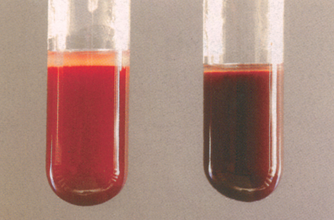 ANÁLISIS QUÍMICO INSTRUMENTAL