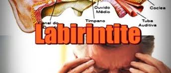 LONGAVIDALONGA: COMO COMBATER A LABIRINTITE COM REMEDIO CASEIRO