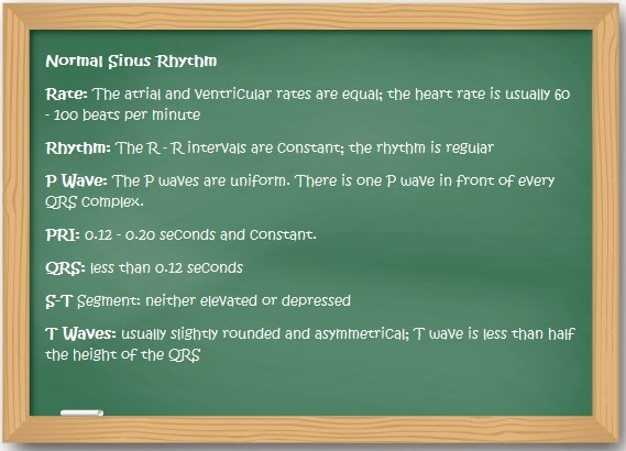 Float Nurse: Basic Rhythm Review: Sinus Rhythms