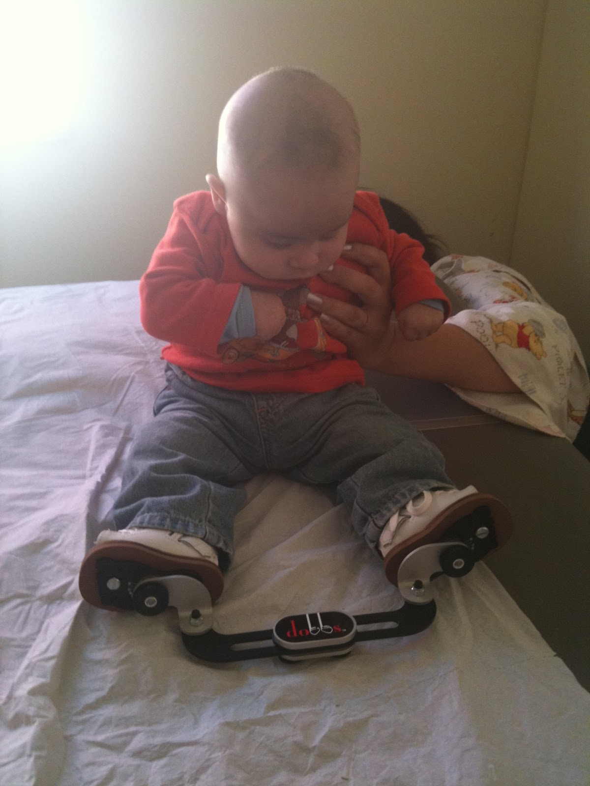 Patologia Pie Bot: Ortesis dinámica Dobbs/tuerca: