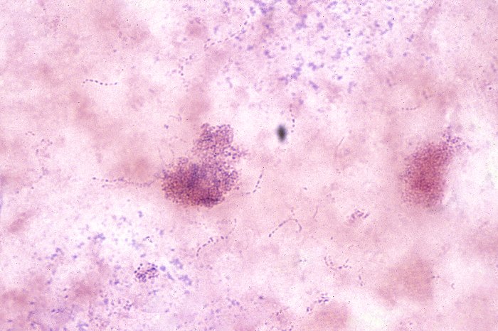 enfermeros microbiologos: Arilene Reyes C. ep 2