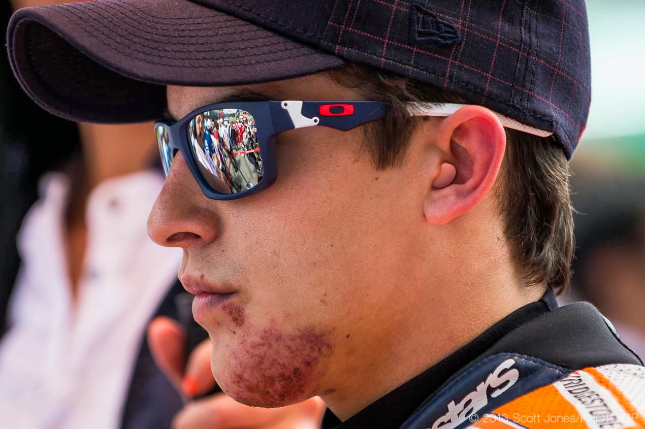 Malaysia Superbike Fans: Anda belum kenal Marc Marquez Jika Belum Baca ...