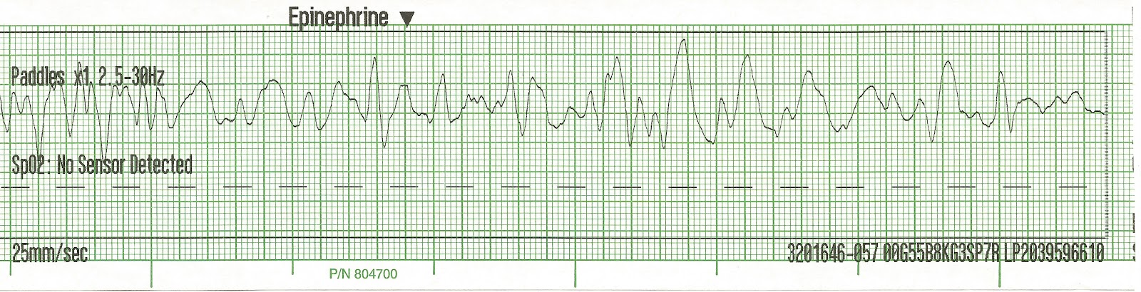 Float Nurse: Code Blue: Cafe Coronary