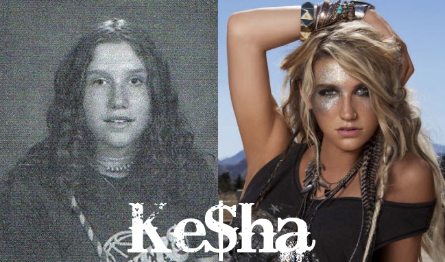 Kesha Plastic Surgery