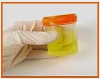 BIOLOGI GONZAGA: UJIAN SISTEM EKSKRESI KELAS XI