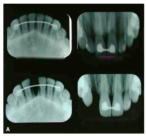 Dental Tooth Fairies: October 2013