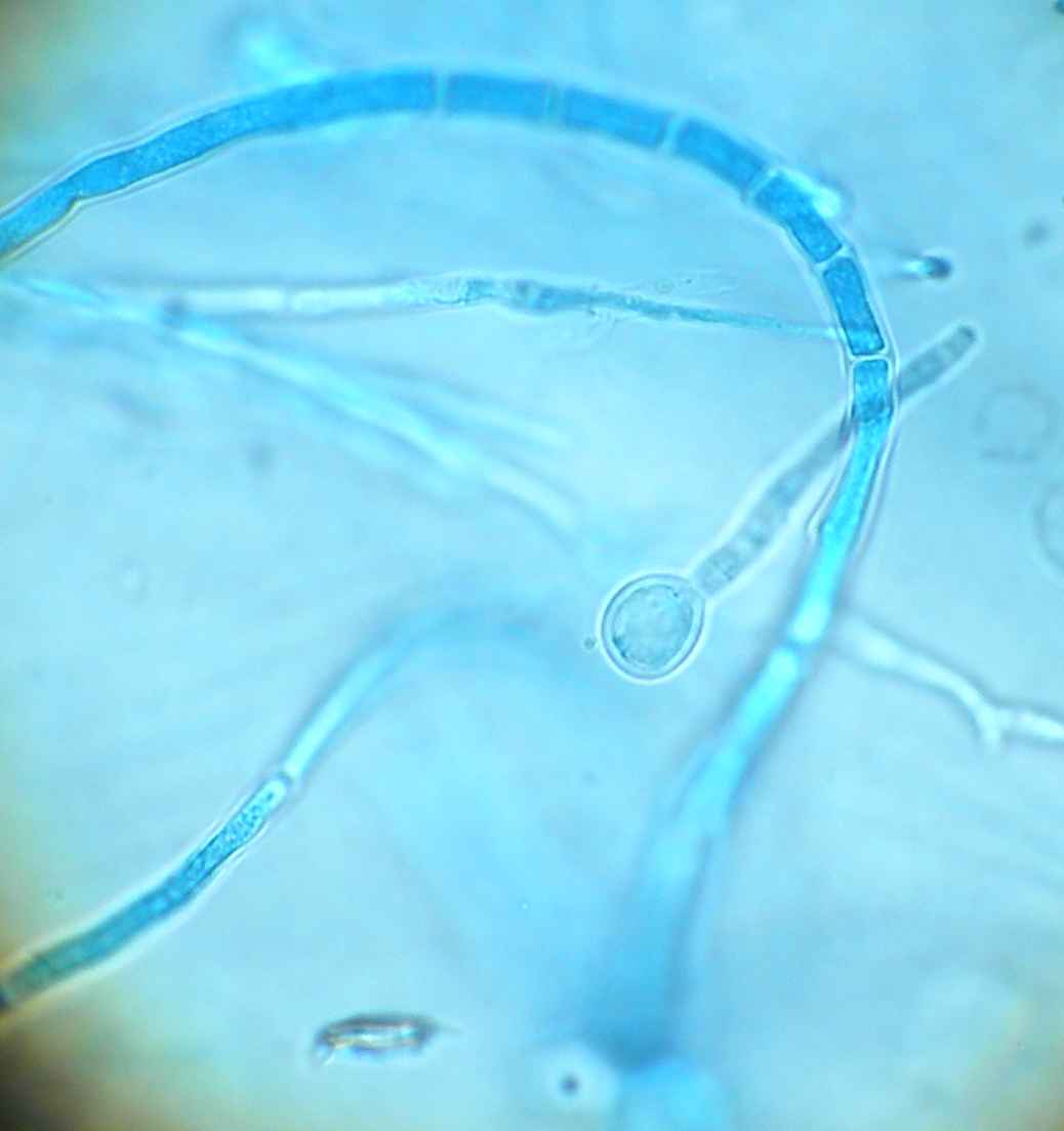 ATLAS MICOLOGIA: NEOSCYTALIDIUM HYALINUM