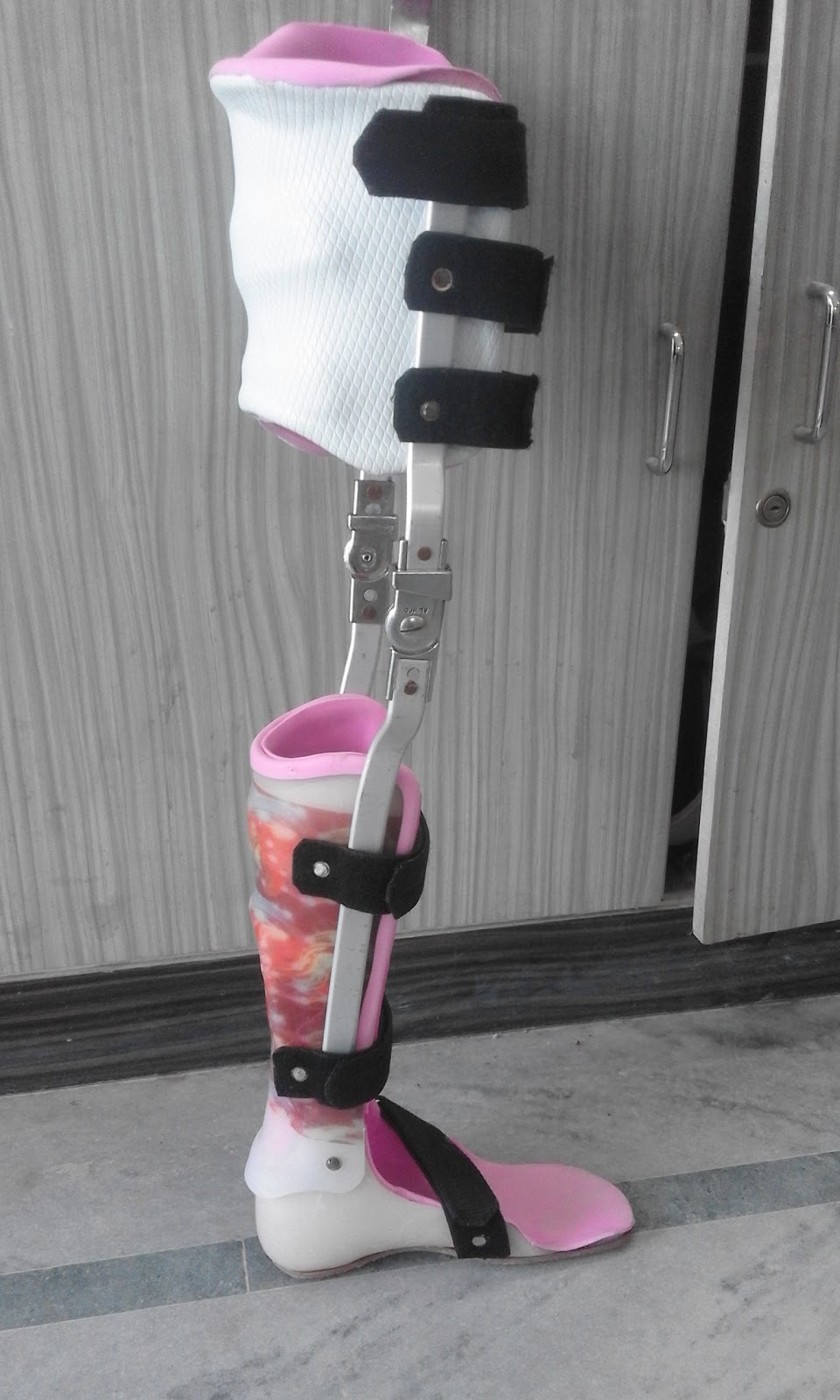 Prosthetics And Orthotics From My Care Calipers For Polio Patients Kafo