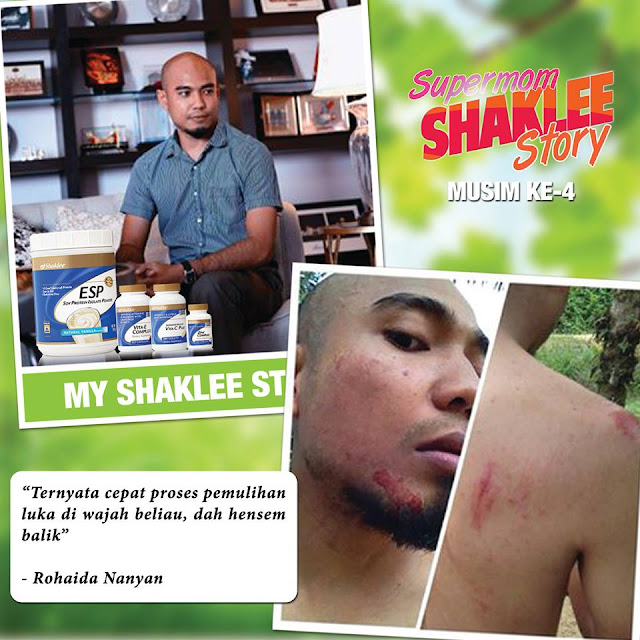 Cara Pulihkan Luka Dan Parut Dengan Cepat - Rahsia Jelita Hawa | Agen ...