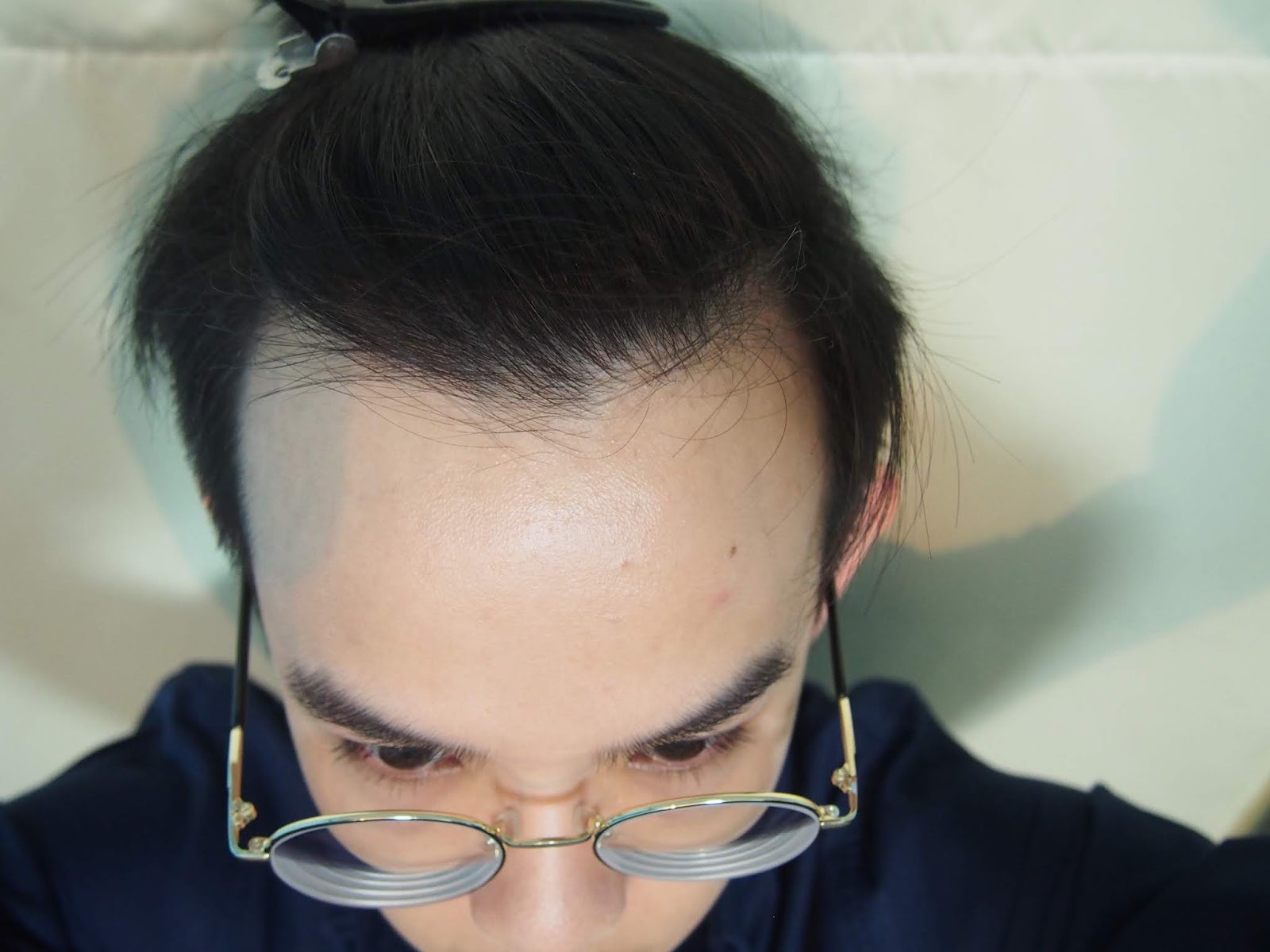 รีวิว : Rava Hair Serum เซรั่มผม สุดยอดสารสกัดจากธรรมชาติ - de rayy