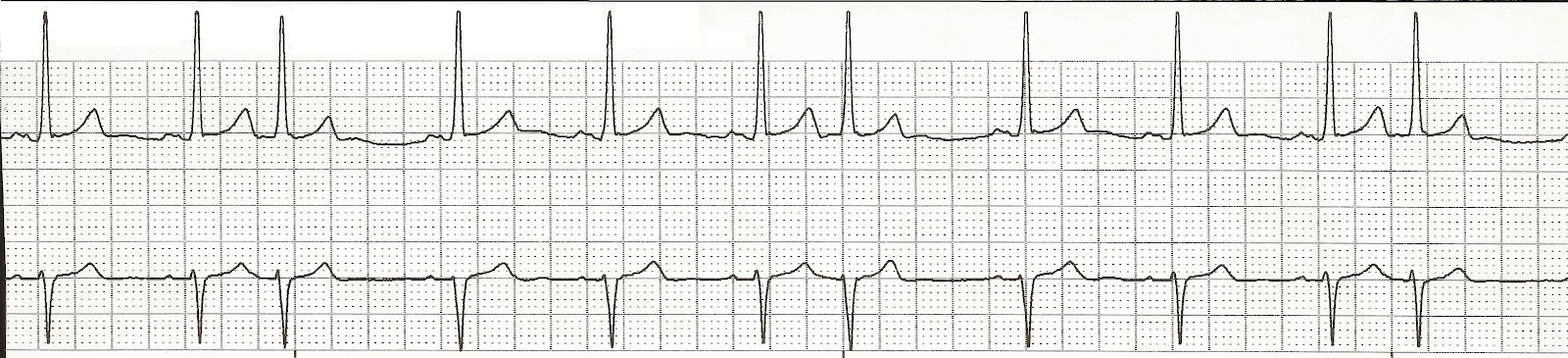 EKG Rhythm Strip Quiz 48