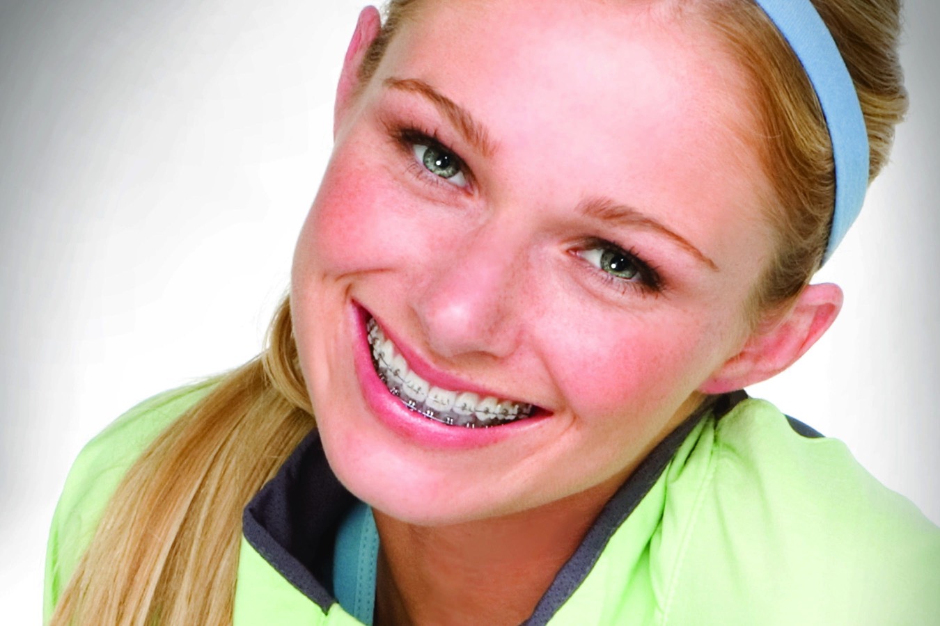 Cómo sonreír con brackets | El HIT GUATE RADIO