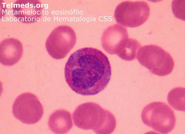 FICHERO DE HEMATOLOGÍA: primera parte