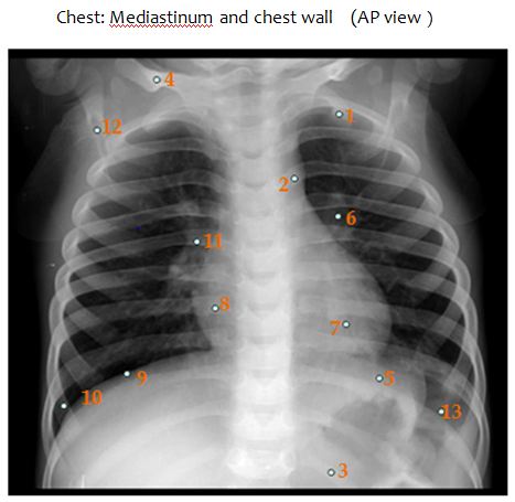 Red- DATA: GAMBAR THORAX (X-RAY KONVENSIONAL)