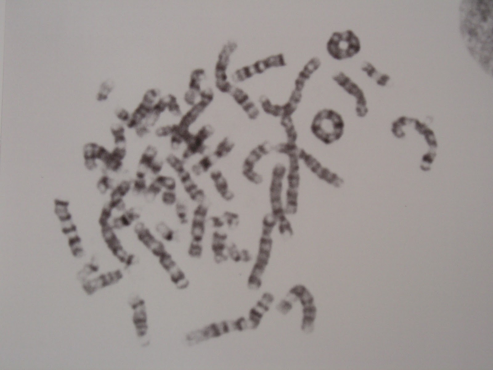 Anomalías cromosómicas - Biología