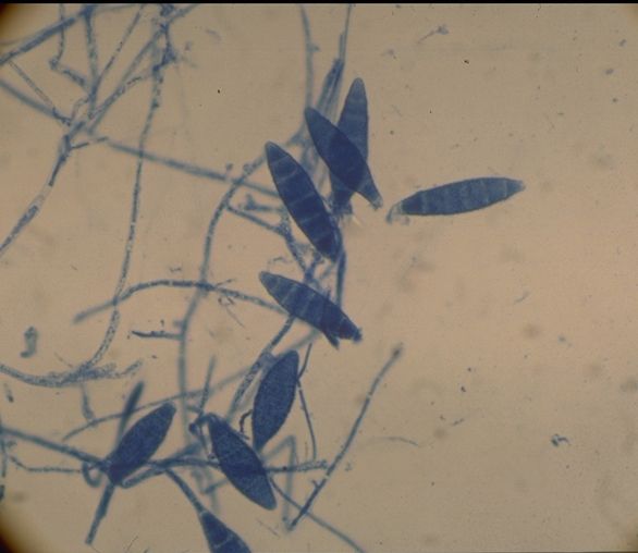 Microbiología y Epidemiología: Microsporum