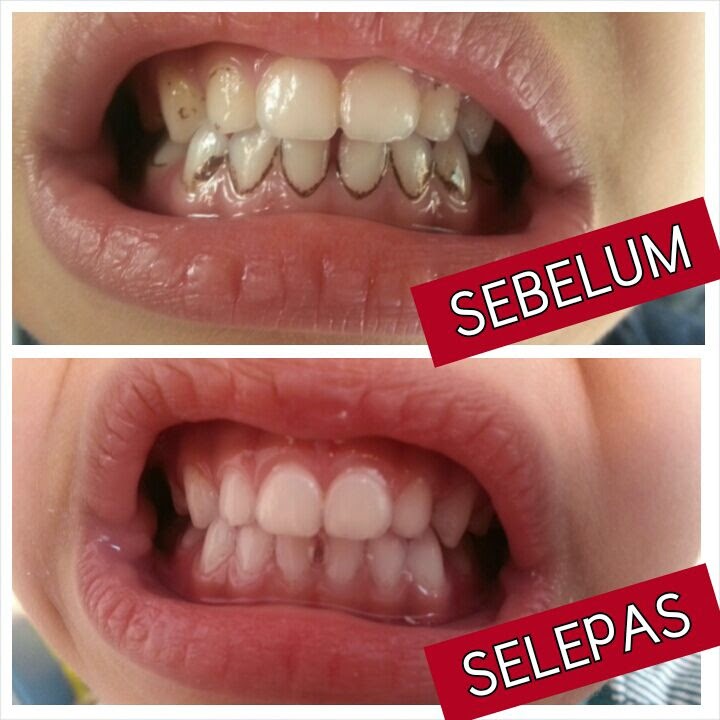 KLINIK PERGIGIAN PUTRA KAJANG: RAWATAN DAN PERKHIDMATAN