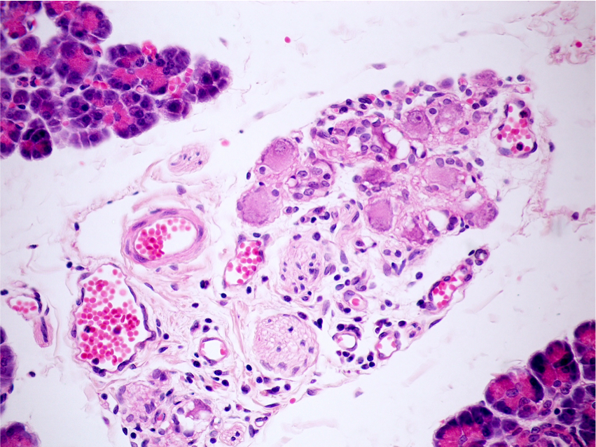 SOS BIOLOGIA CELULAR Y TISULAR: TEJIDO NERVIOSO