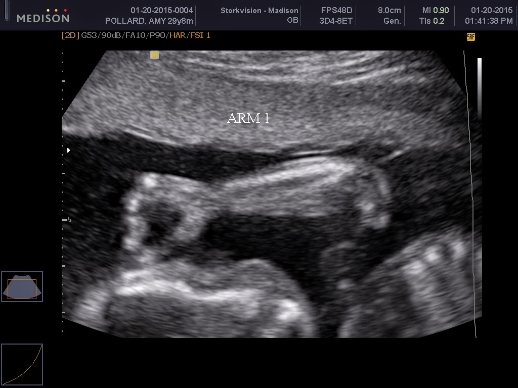 Pollard Family: Baby Pictures