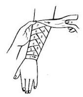 Vida hospitalaria: Tipos de vendajes