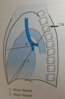 images for x ray: major and minor fissure