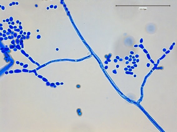 Fun With Microbiology (What's Buggin' You?): Chrysonilia sitophila