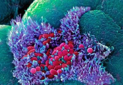 VINDECARE NATURISTA: REFACEREA FLOREI INTESTINALE