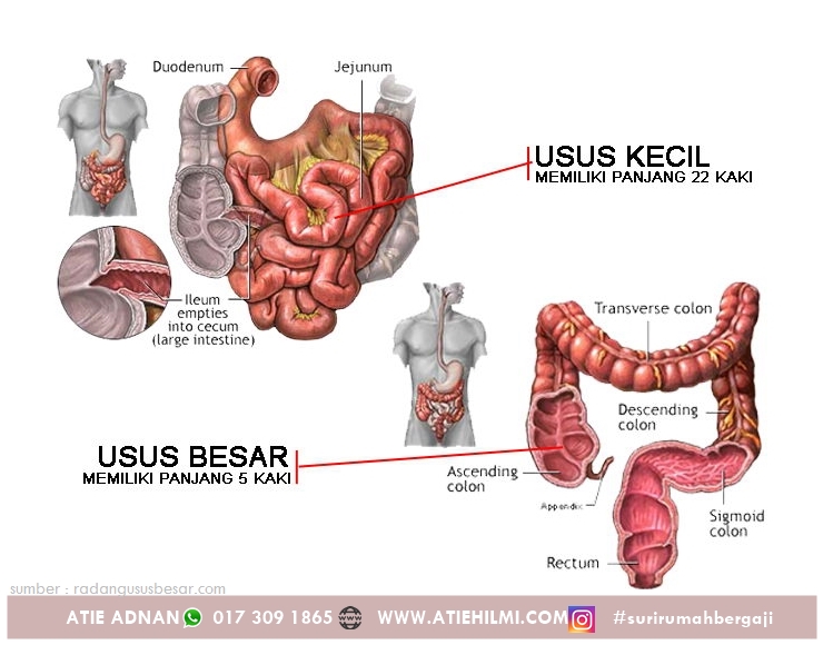 KESAN DAN TINDAKBALAS USUS ROSAK TERHADAP SISTEM TUBUH - atiehilmi.com ...