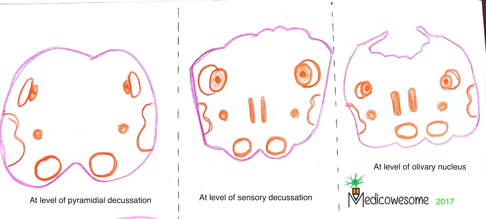 Medicowesome: Medulla (Fun Mnemonic Diagrams)