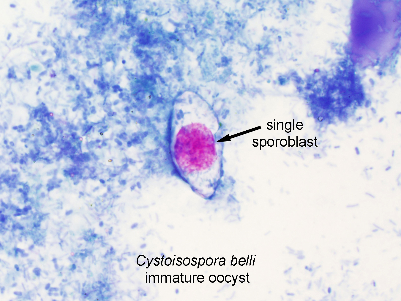 Creepy Dreadful Wonderful Parasites: Answer to Case 403