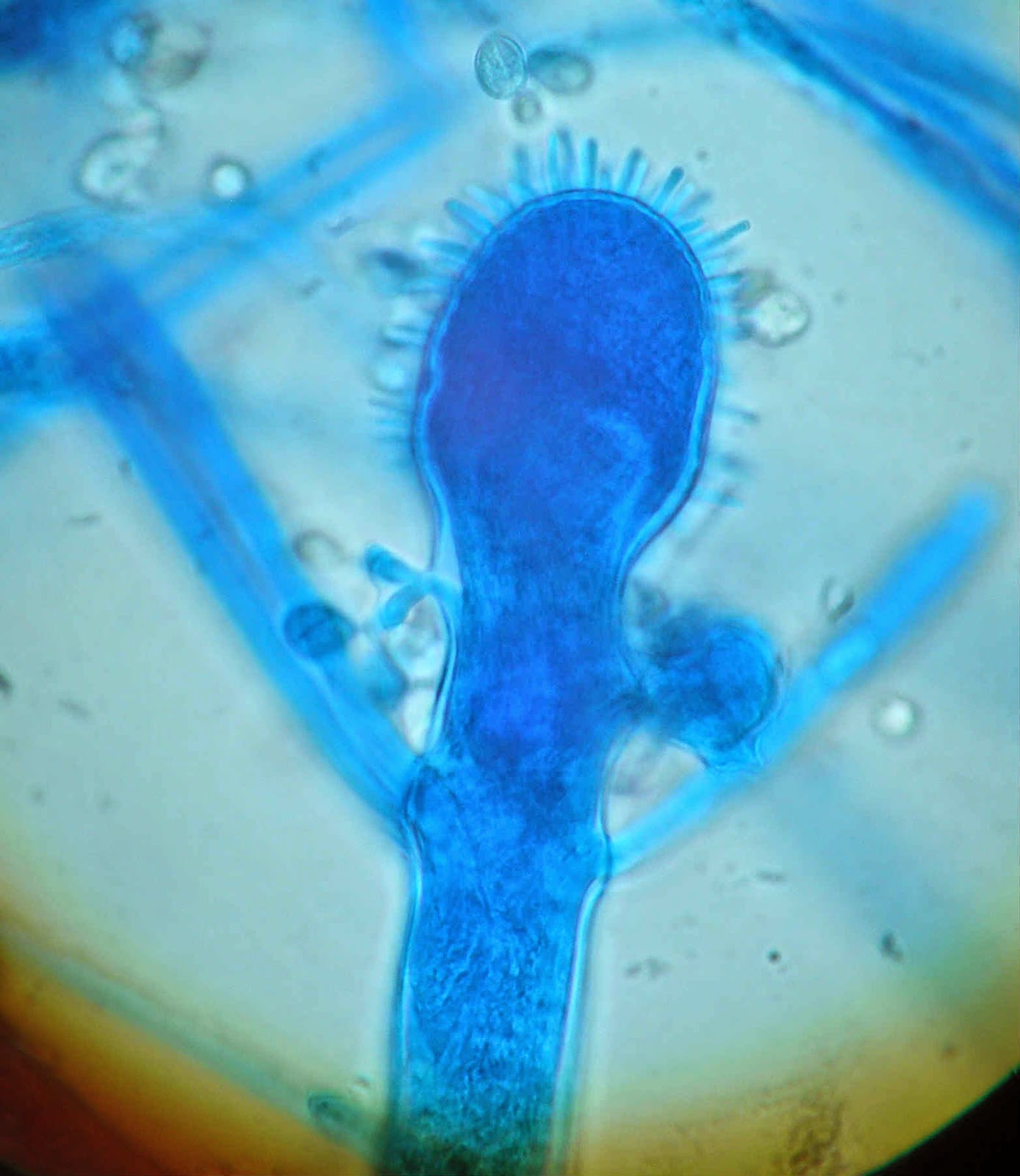 ATLAS MICOLOGIA: CUNNINGHAMELLA BERTHOLLETIAE