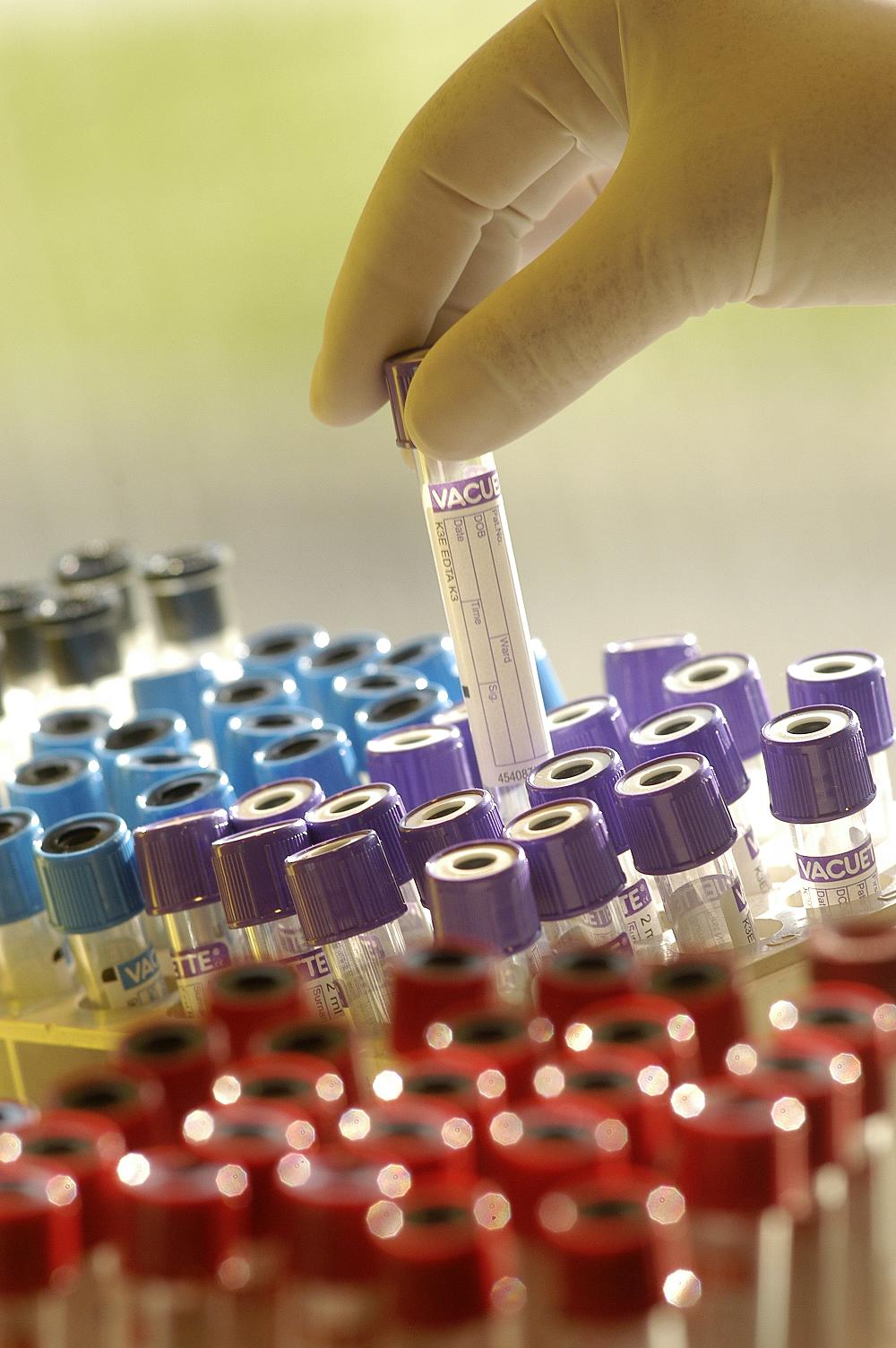 Laboratorio Clínico: Servicios Del Laboratorio Clínico