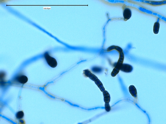 Fun With Microbiology (What's Buggin' You?): July 2015